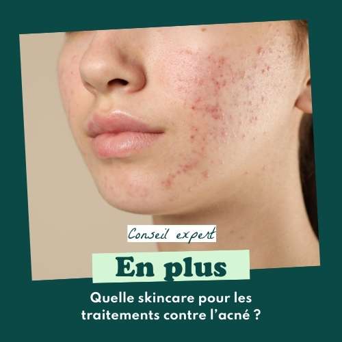 Boutons sur le visage : signification selon leur emplacement
